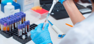 lab testing | cbc blood test | blood test labs near me | tsh blood test