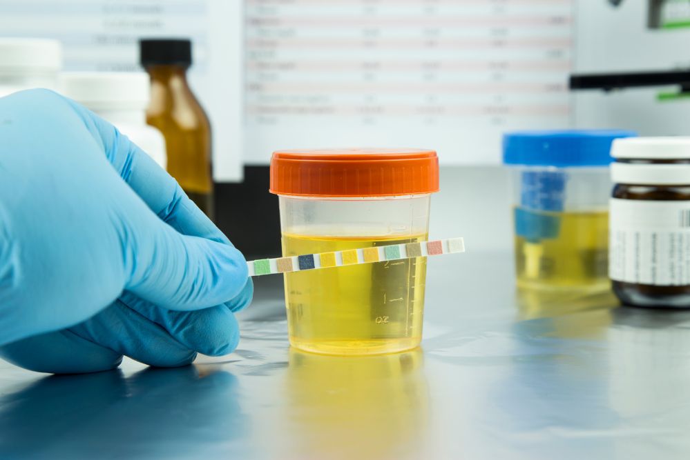 UTI Testing | UTI Treatment | Urinary Tract Infection | UTI Testing Near Me